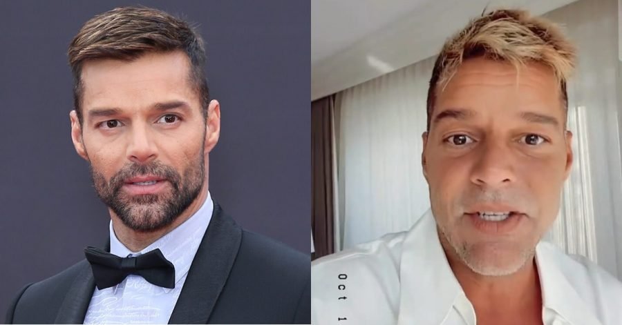 Ricky Martin afirma en sus redes que no se hizo "retoques" en su rostro ...